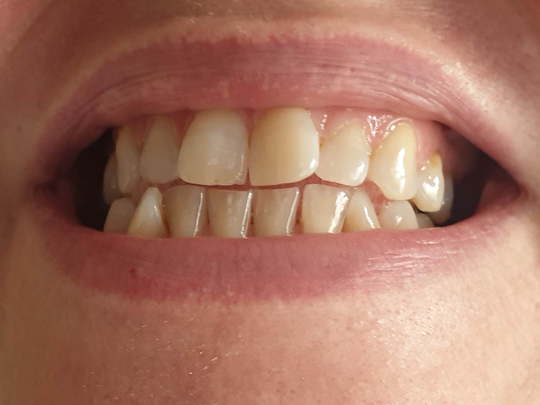 Price and Guarantee | Contident Dental Clinic